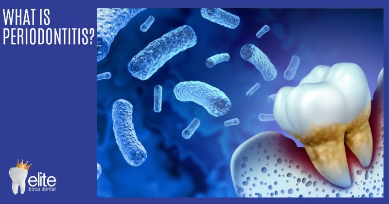 Dentist in Boca Raton | Dr. Michael Pechan DMD | Elite Boca Dental